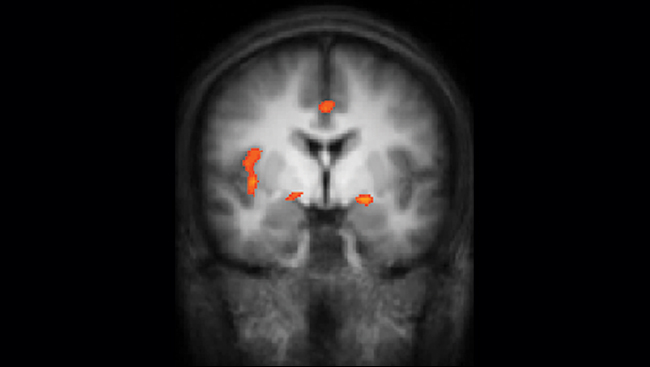 Fear and Post-Traumatic Stress Disorder