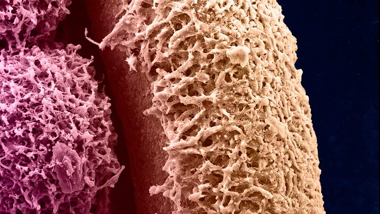 Brains and Brawn Packed Like Peas in a Pod