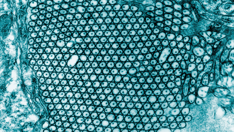 Axons Travel In Groups