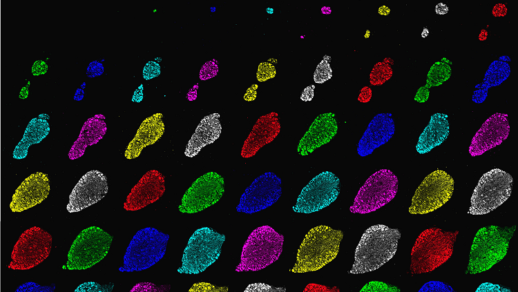 The Gatekeepers of Sensation