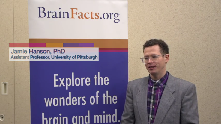 Jamie Hanson: Falling Outside the Norms