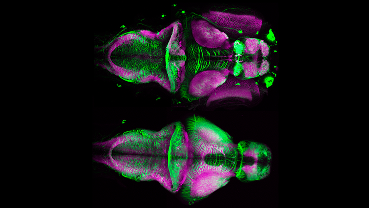 Zebrafish Embryo Brain