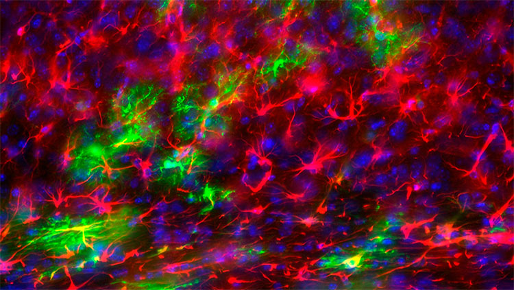 Green Fluorescent Protein