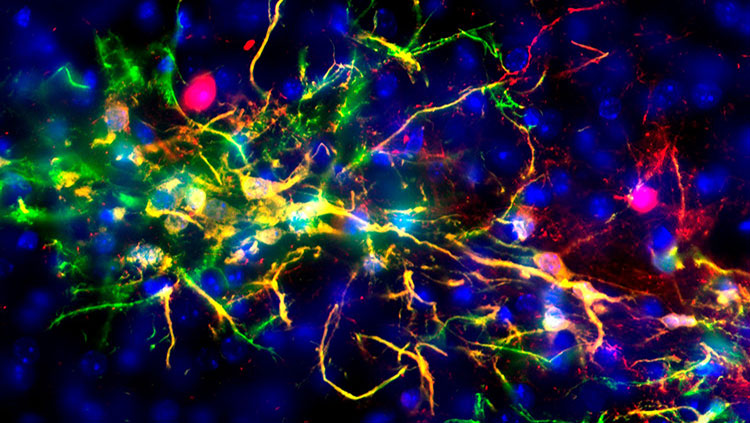 New Cells for a Renewed Brain