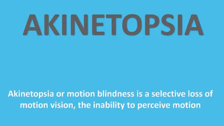 Akinetopsia